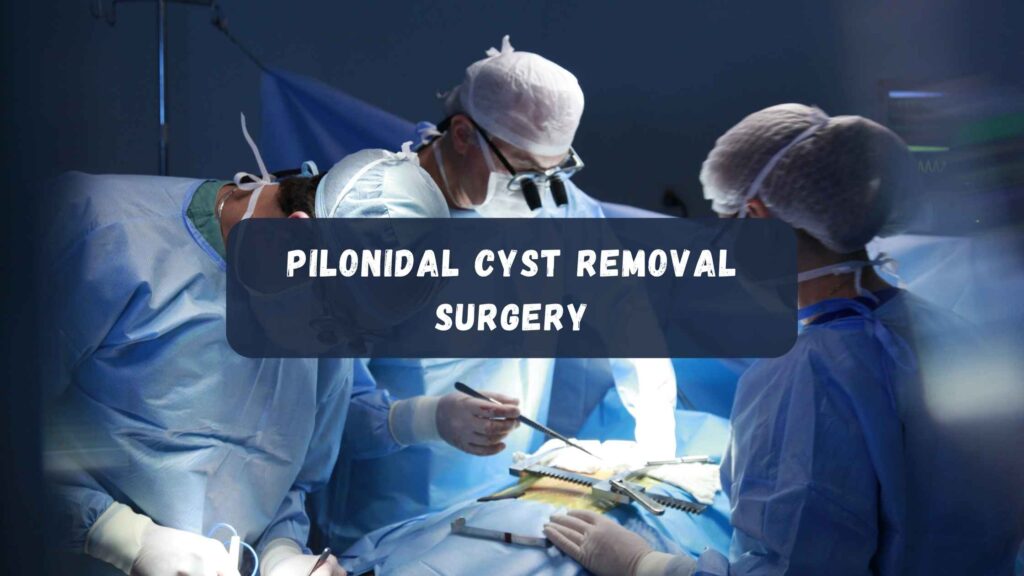 Surgery for Pilonidal Cysts: What to Expect - TotalStationPlaza